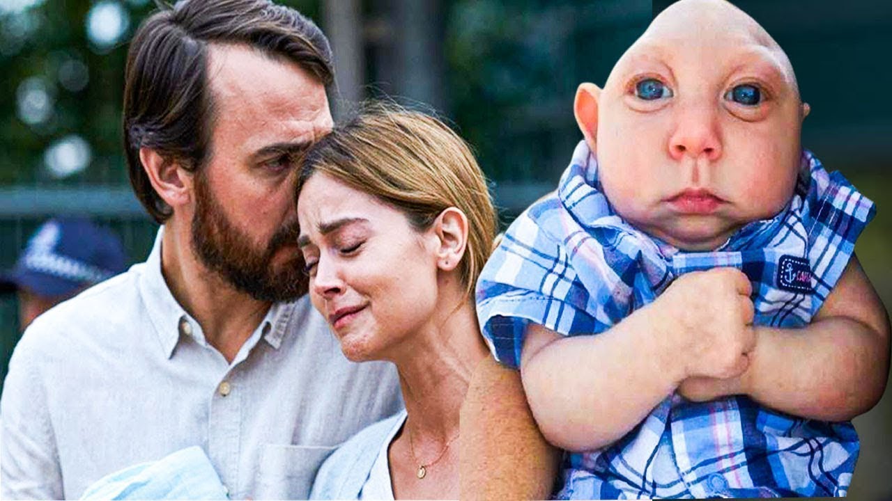 Boy Born Without A Brain, 6 Years Later Look At What Doctors Find ...