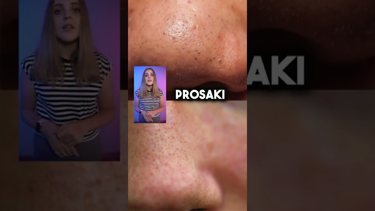 Prosaki, zaskórniki, rumień najlepsze kosmetyki #shorts # ...