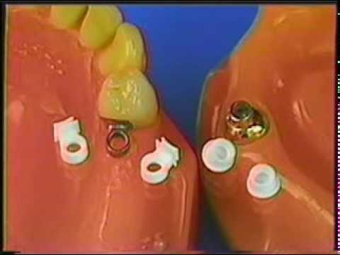 Presentación Sterngold - YouTube