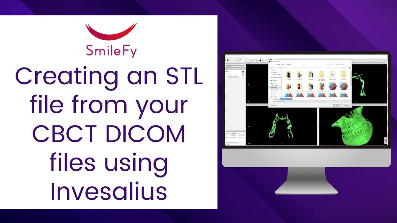 Tutorial: Creating an STL file from your CBCT DICOM files using ...