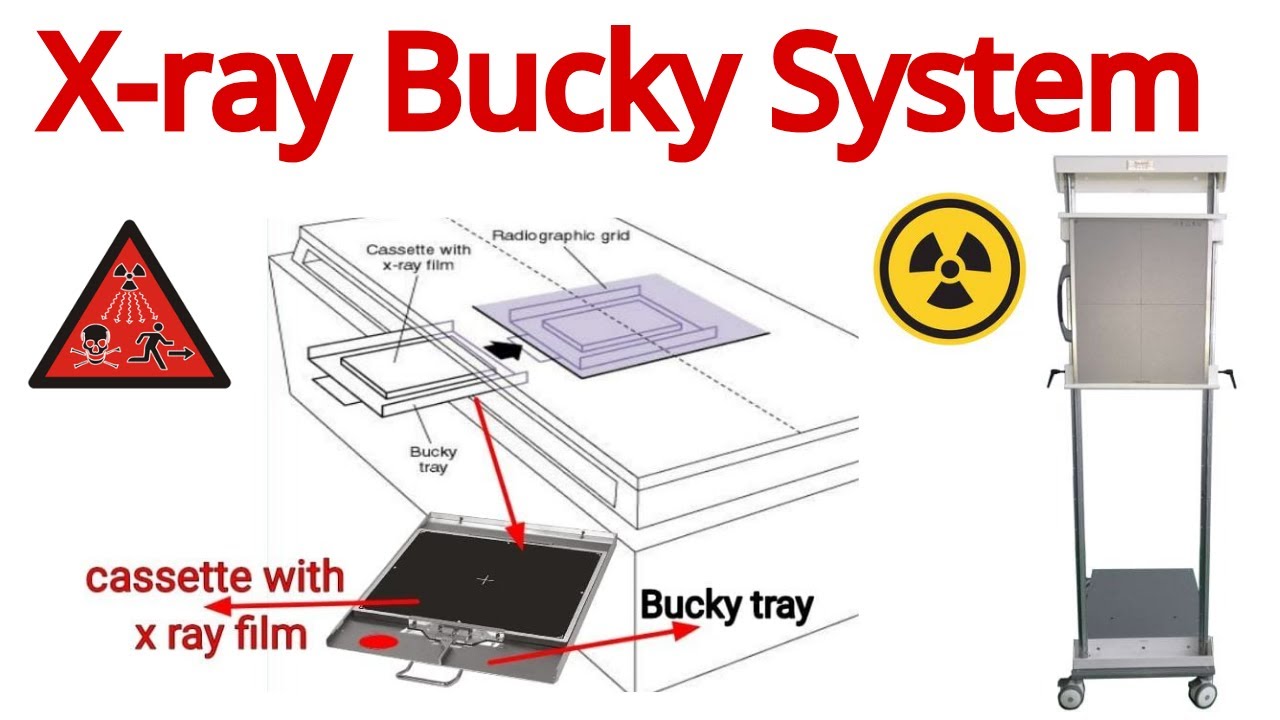 X Ray Bucky X Ray Bucky Table What Is X Ray Bucky table Bucky