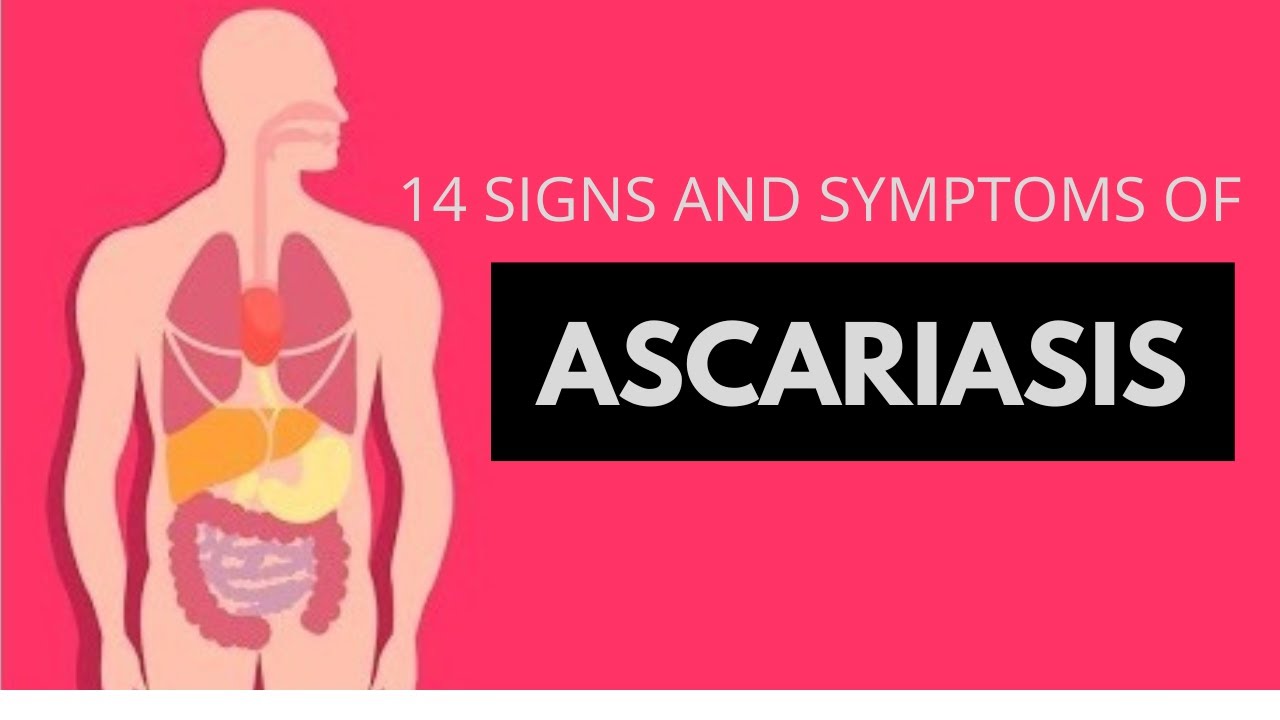 14 SIGNS AND SYMPTOMS OF ASCARIASIS - YouTube