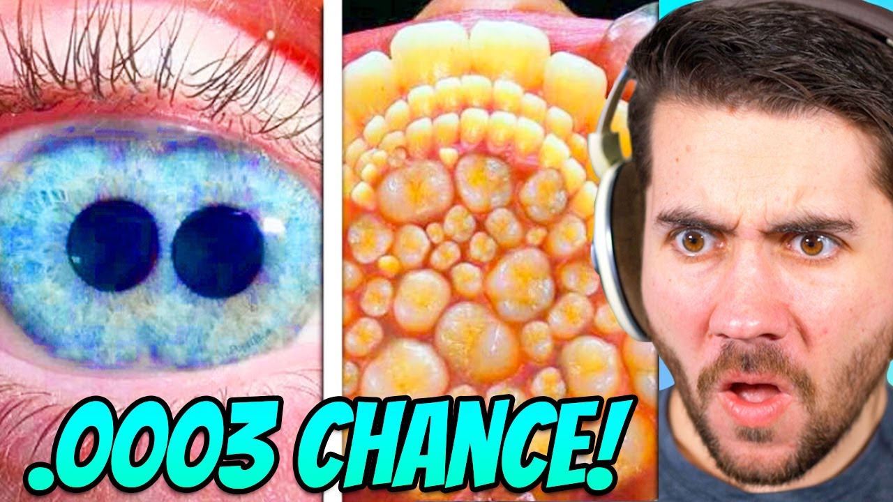 Rare Features .0003% Of The World Have! - YouTube