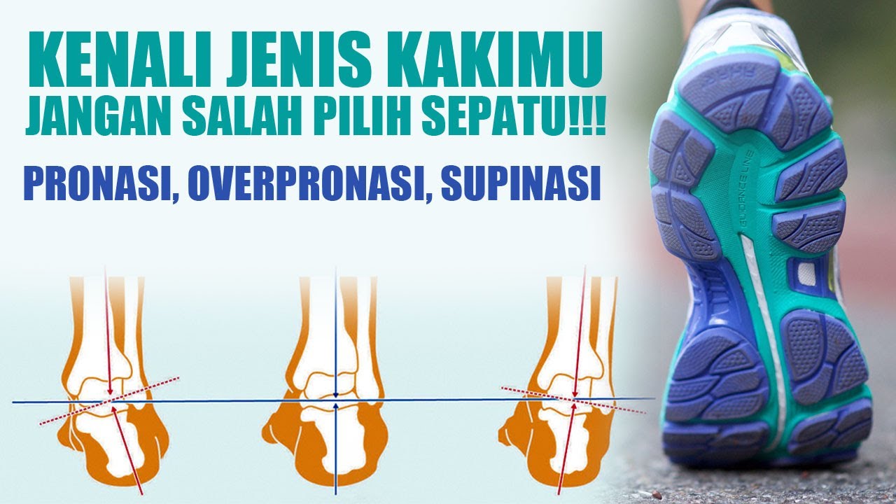 Pronasi, Overpronasi dan Supinasi - YouTube