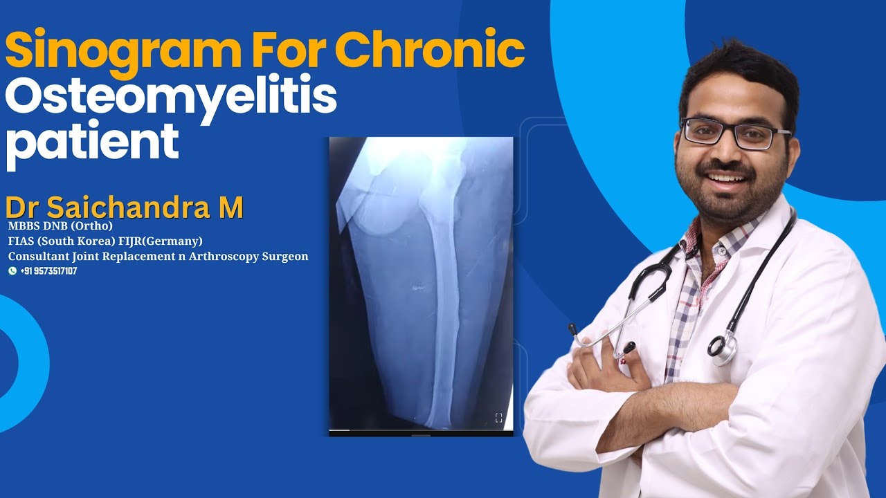 Sinogram For Chronic Osteomyelitis patient...Dr Sai Chandra - YouTube