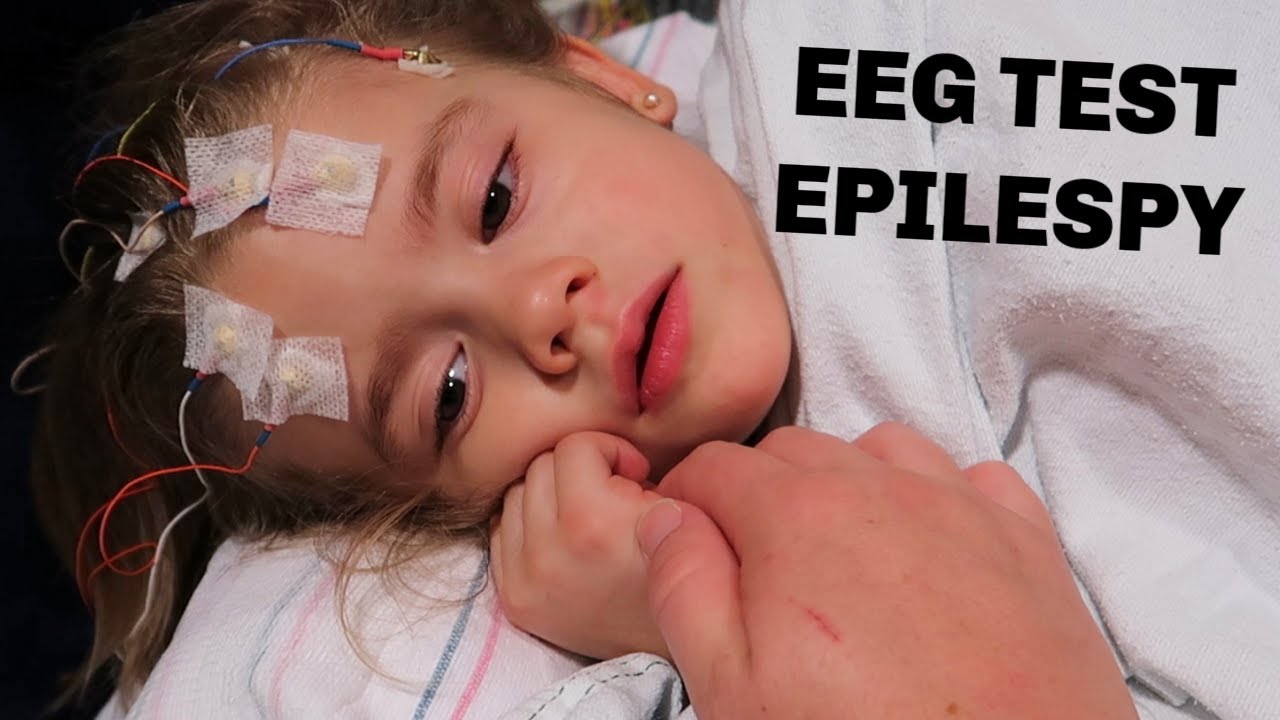 EEG Test Epilepsy Assumptions About Us JayHemp eeg-test-epilepsy-assumptions-about-us-jayhemp