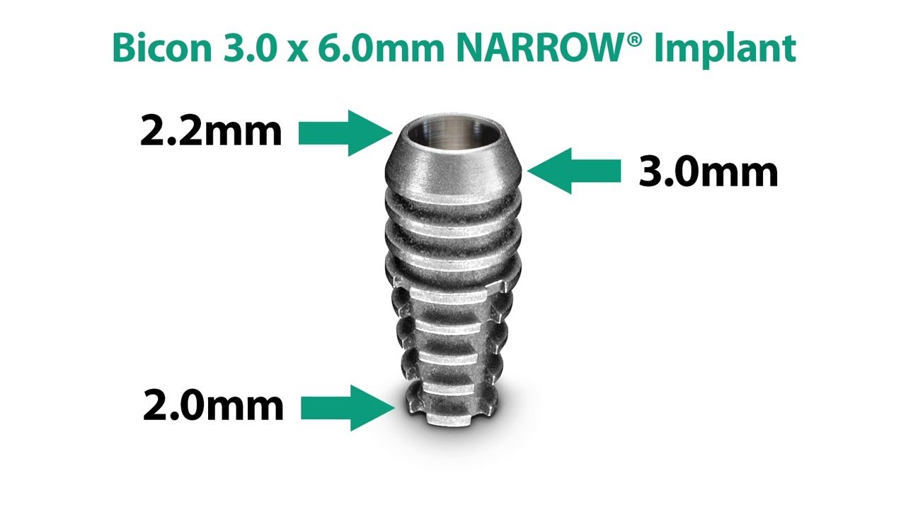 Clinical Capabilities of the Bicon 3.0 x 6.0mm NARROW® Implant - YouTube