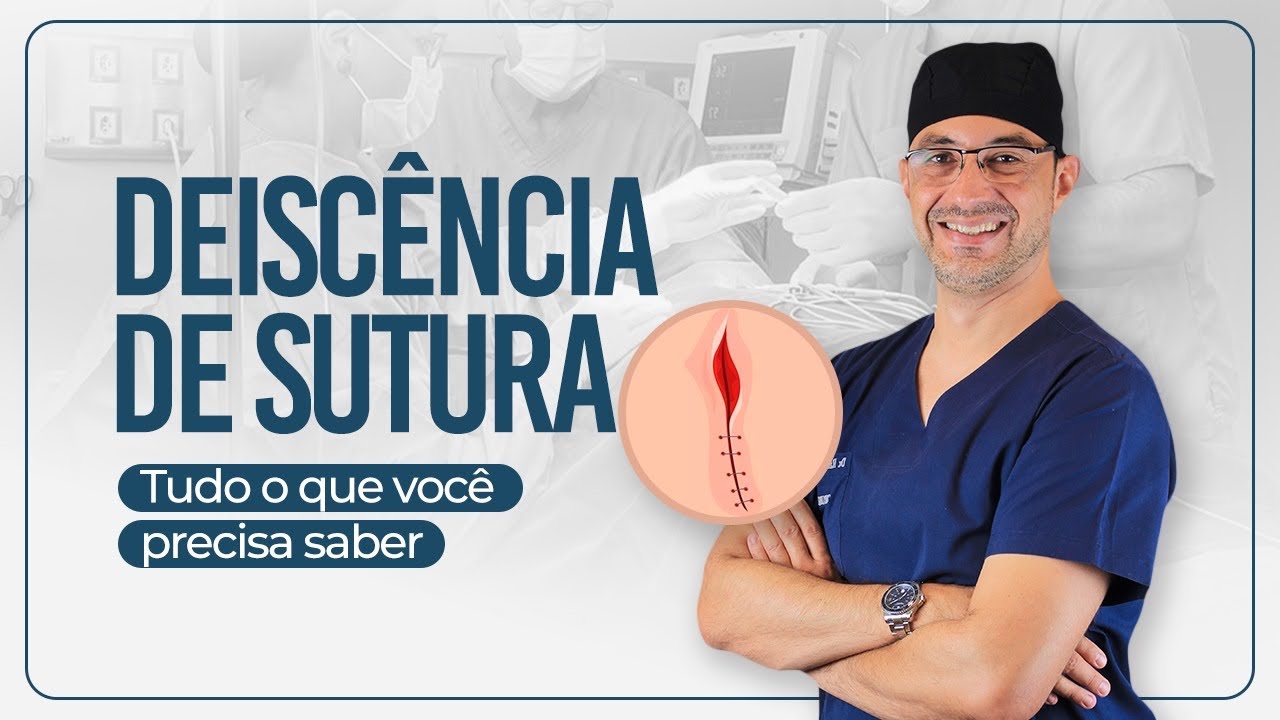 Tudo sobre Deiscência de Sutura | O que fazer? - YouTube