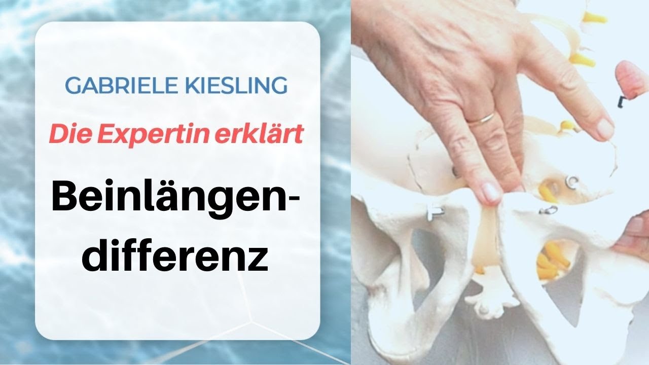 Beckenschiefstand und funktionelle Beinlängendifferenz schnell erklärt ...