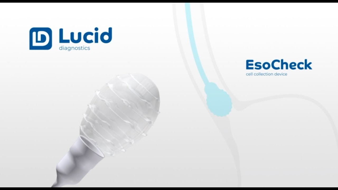 EsoCheck™ Esophageal Cell Collection Device - YouTube