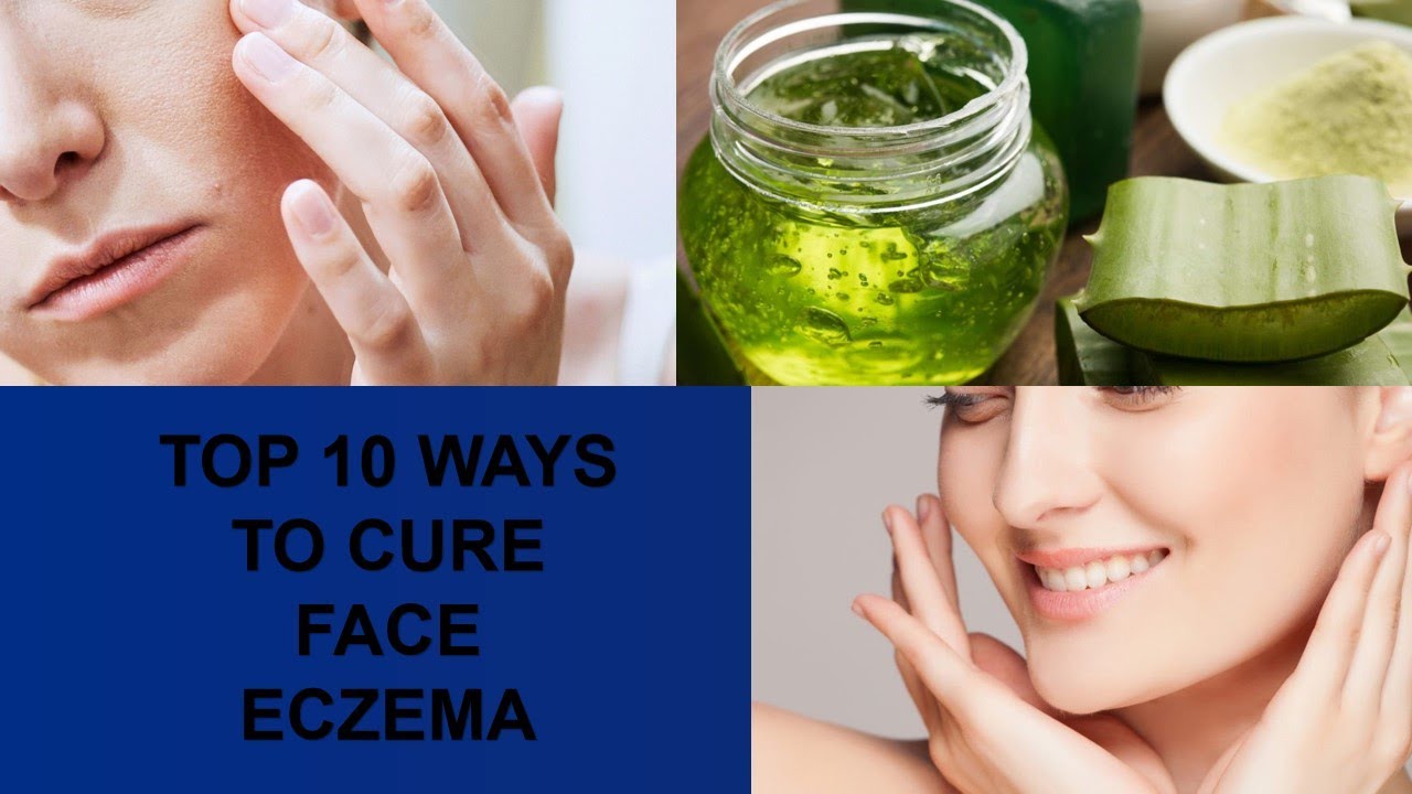 Top 10 Ways to Cure Face Eczema | How to cure Eczema Naturally | # ...