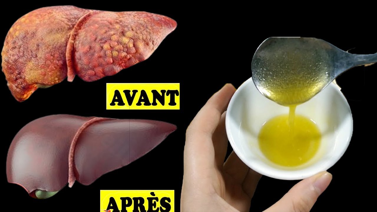 Nettoyez votre foie en quelques jours | Seulement avec le mélange créé ...