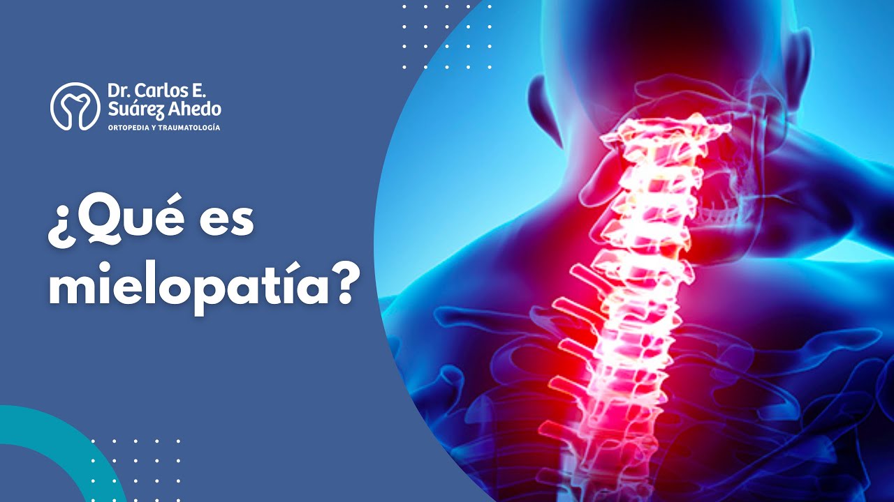 ¿Qué es la Mielopatía? - YouTube