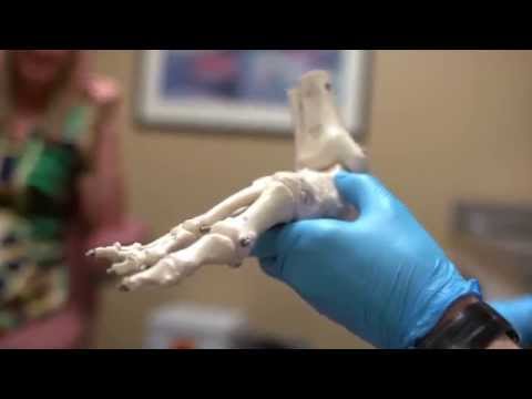 Ankle Surgery with Podiatrist Dr. Randy Lew