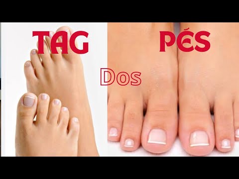 TAG DOS PÉS:esfoliação e remoção de peles mortas #tag #pes2023 pes ...