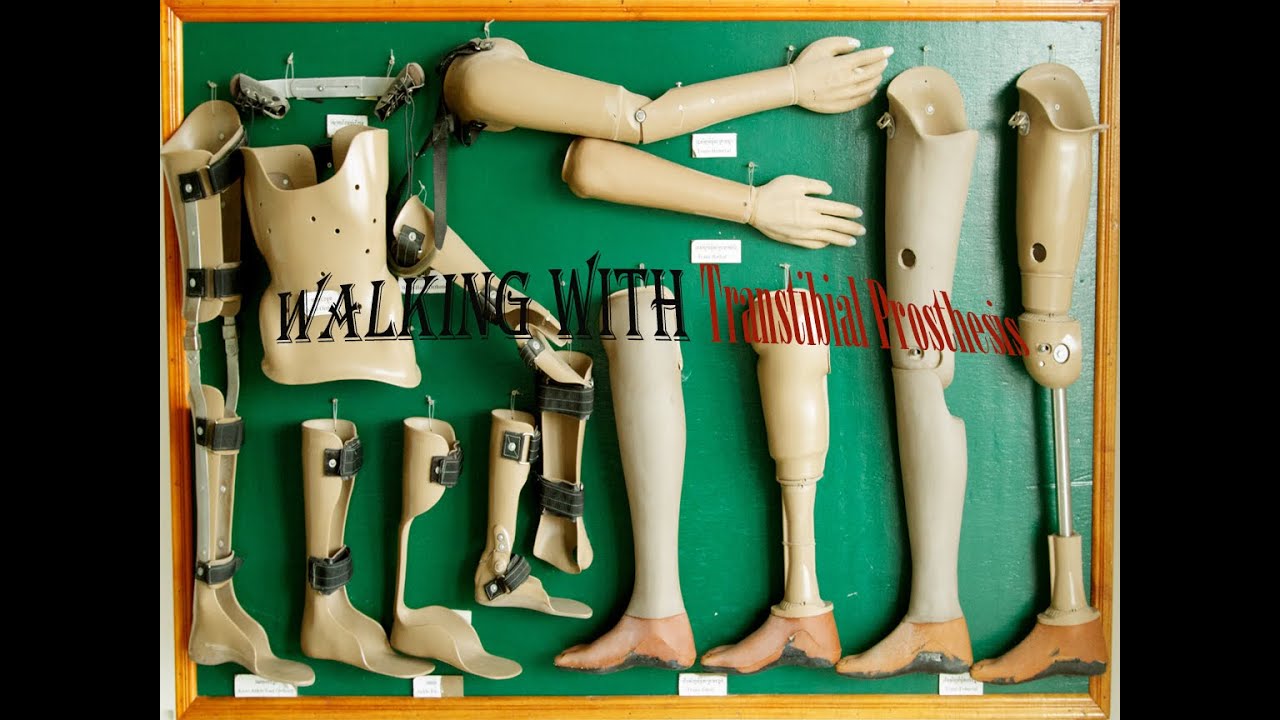 Prosthetic Leg - Walking Exercise With Knee Prosthesis - YouTube