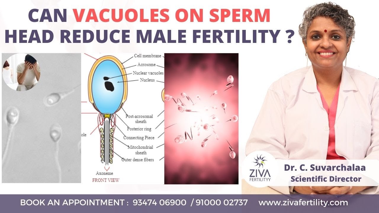 Sperm Head Vacuoles || Treatment and Management || Sperm Morphology ...