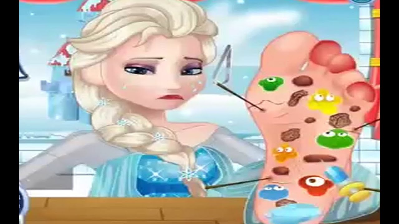 Disney Princess Frozen Elsa Foot Doctor Game - YouTube