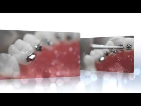 Orapix Turkey - YouTube