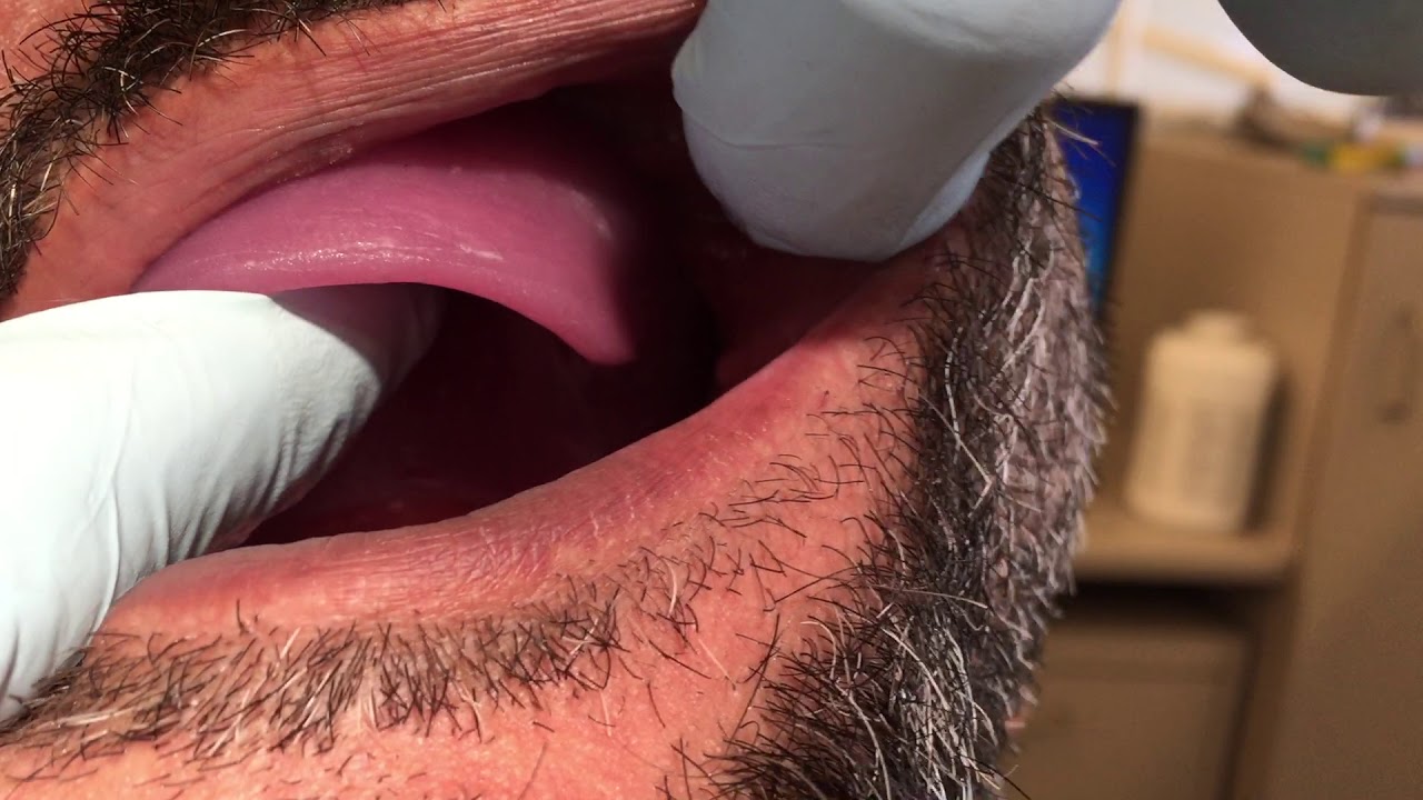 1e) Border Molding #1 - YouTube