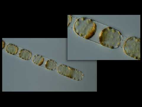 Cell division in the diatom Stephanopyxis - YouTube
