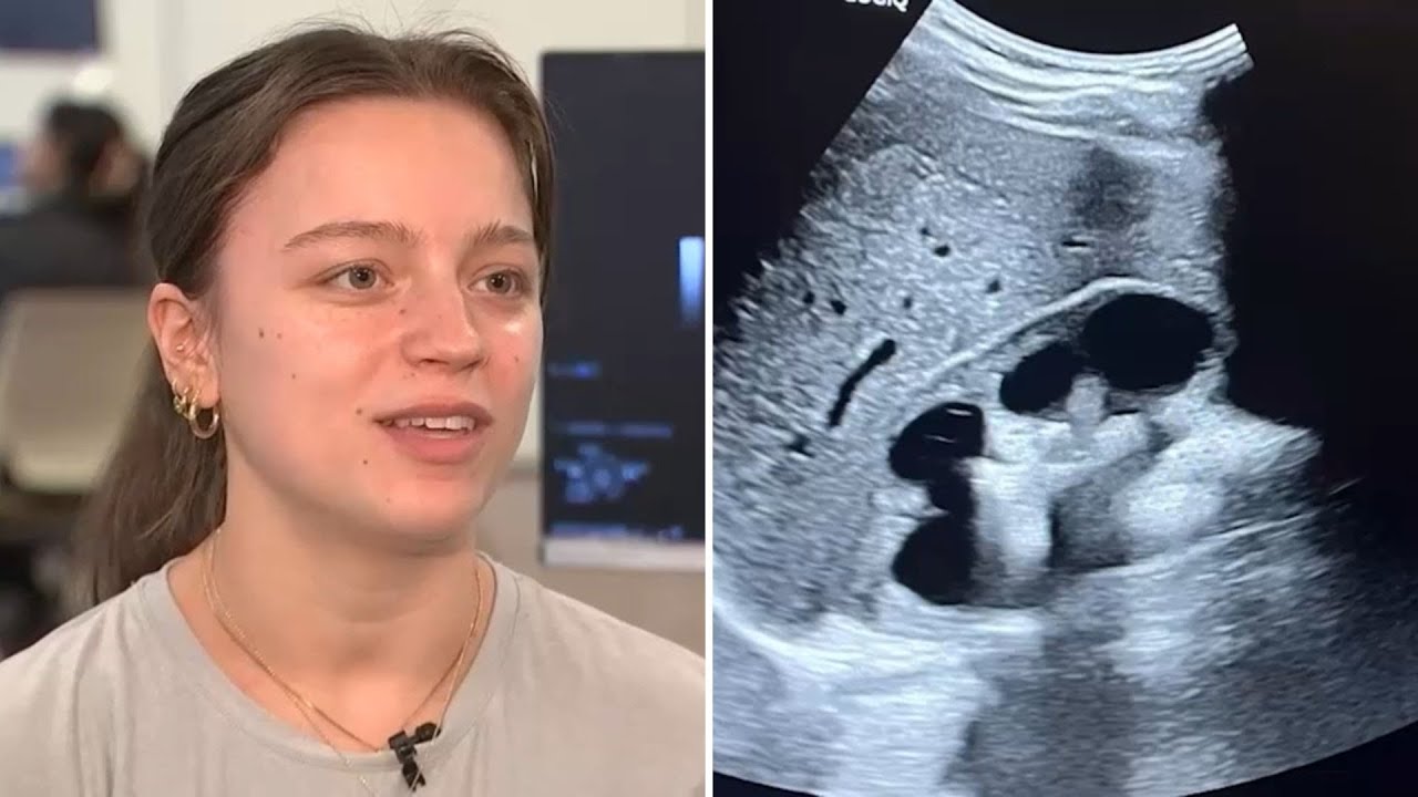 First-year medical student volunteered for a class ultrasound — then ...