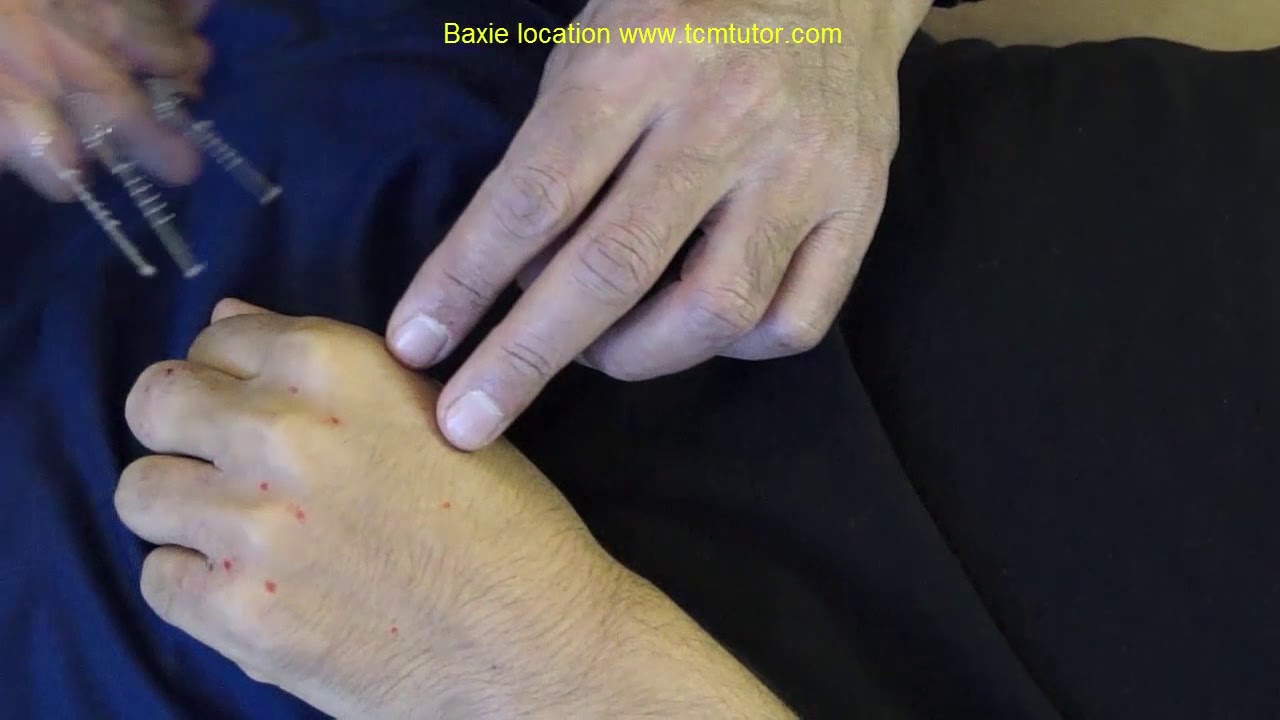 How to locate Baxie (Eight Pathogens) points - YouTube