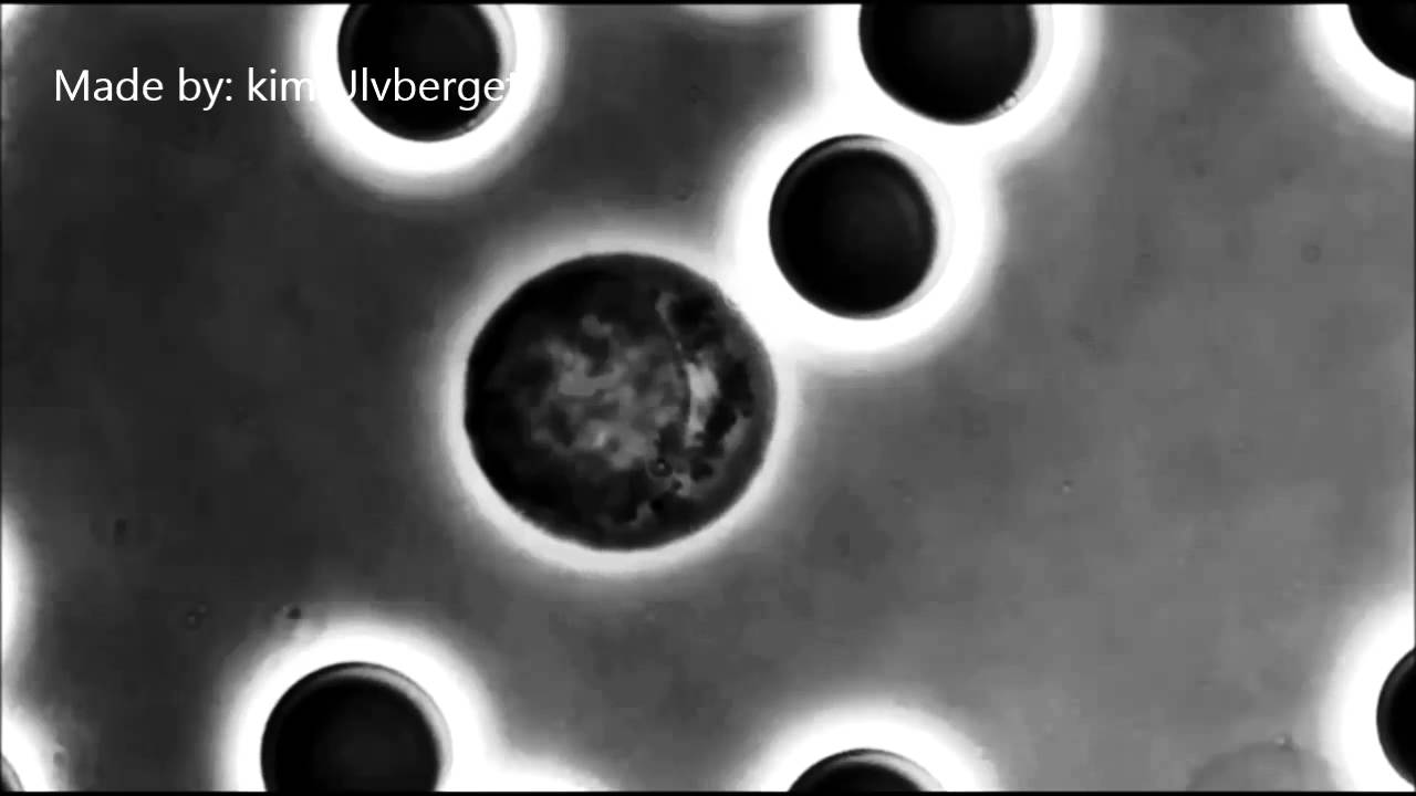The amazing T-cell! white blood cell microscopy - YouTube