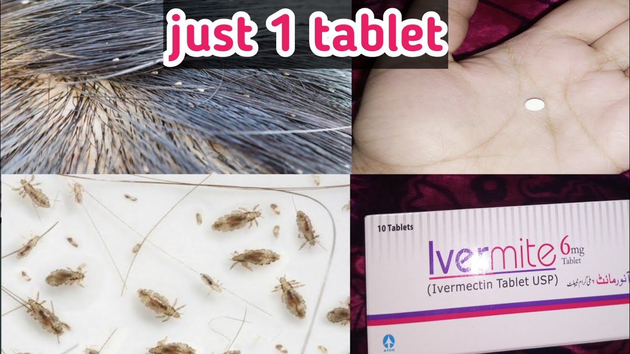 anti lice tablet|ivermite 6mg tablet for lice |ivermectin|lice and nits ...