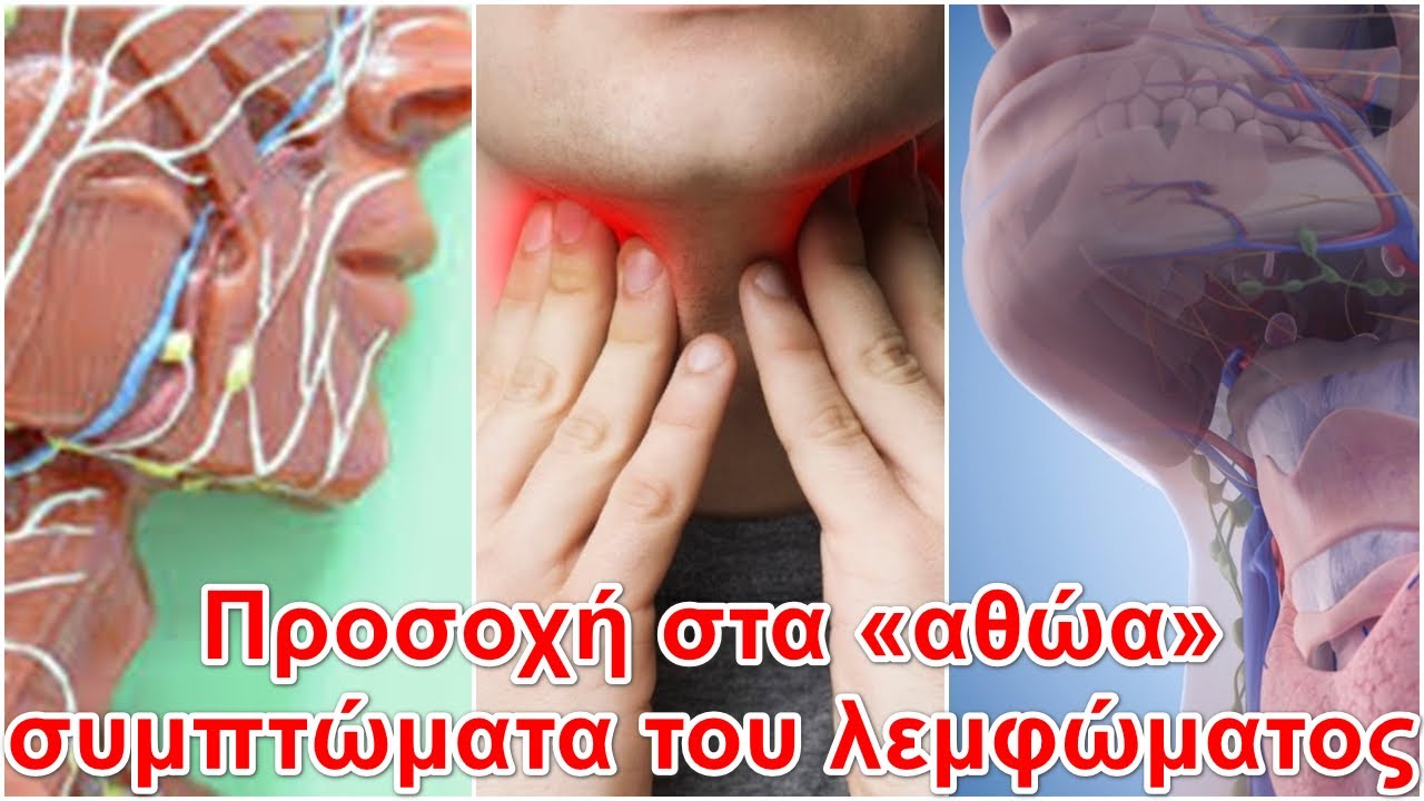 Προσοχή στα «αθώα» συμπτώματα του λεμφώματος - YouTube