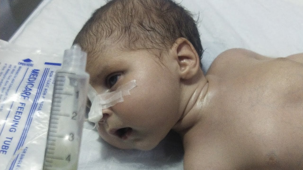 "Gentle Baby Massage in NICU – Comfort & Care for Tiny Souls" - YouTube