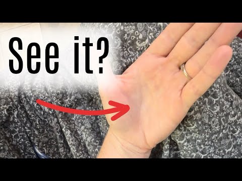 How To Remove Tiny Seed Ticks