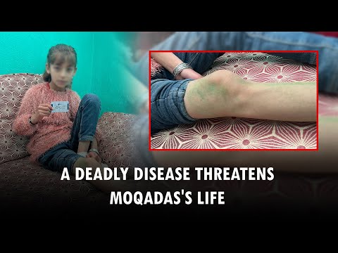 Fundraiser by Kamran Safi : Help Save Moqadas: A Young Dreamer Fighting ...