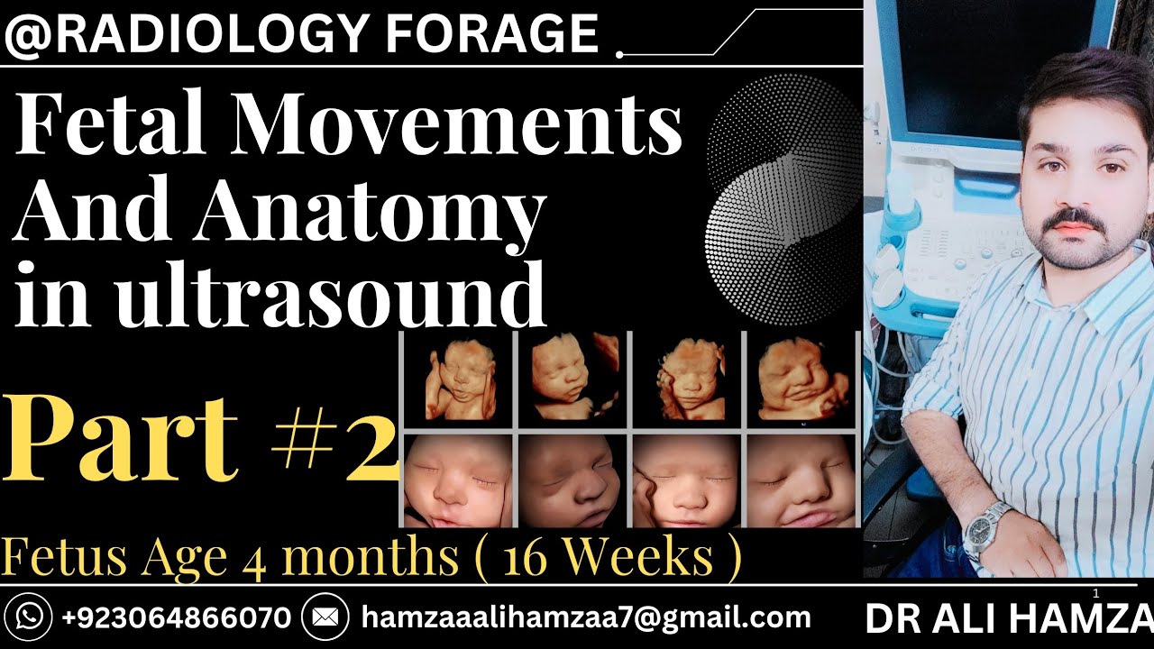 Fetal Movements In Ultrasound | Complete Fetus Anatomy | Part 2 - YouTube