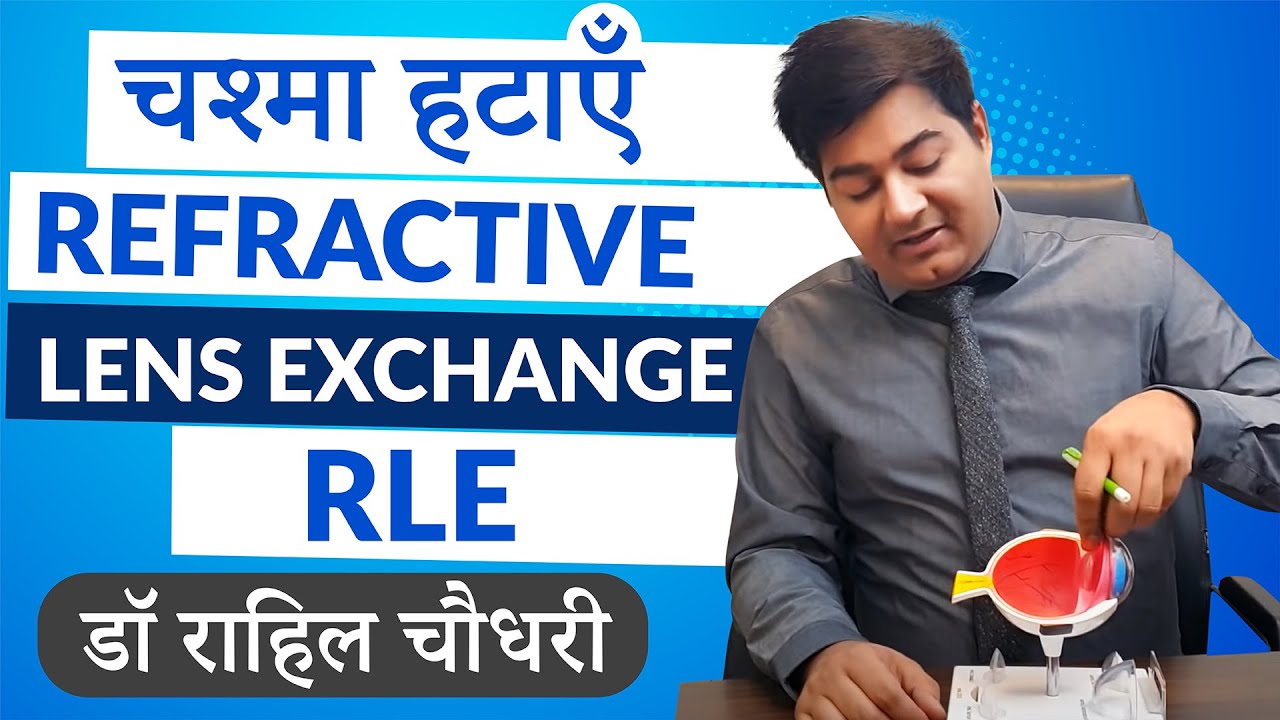 Refractive Lens Exchange for Specs Removal | RLE से चश्मा हटाए | Dr ...