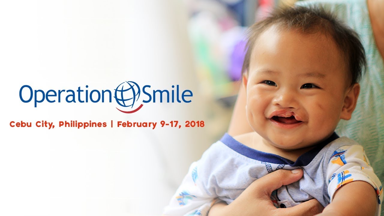 OPERATION SMILE Cebu 2018 - YouTube