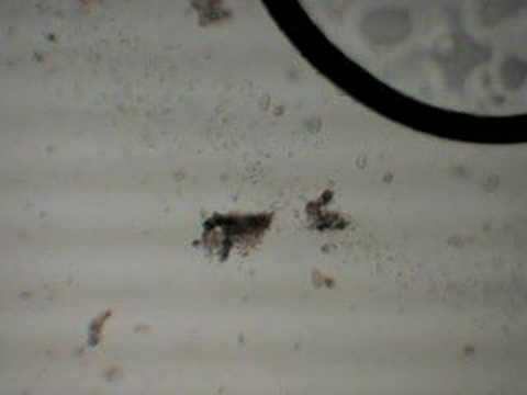 Flagellata(costia) in discus fish's slime x100 - YouTube