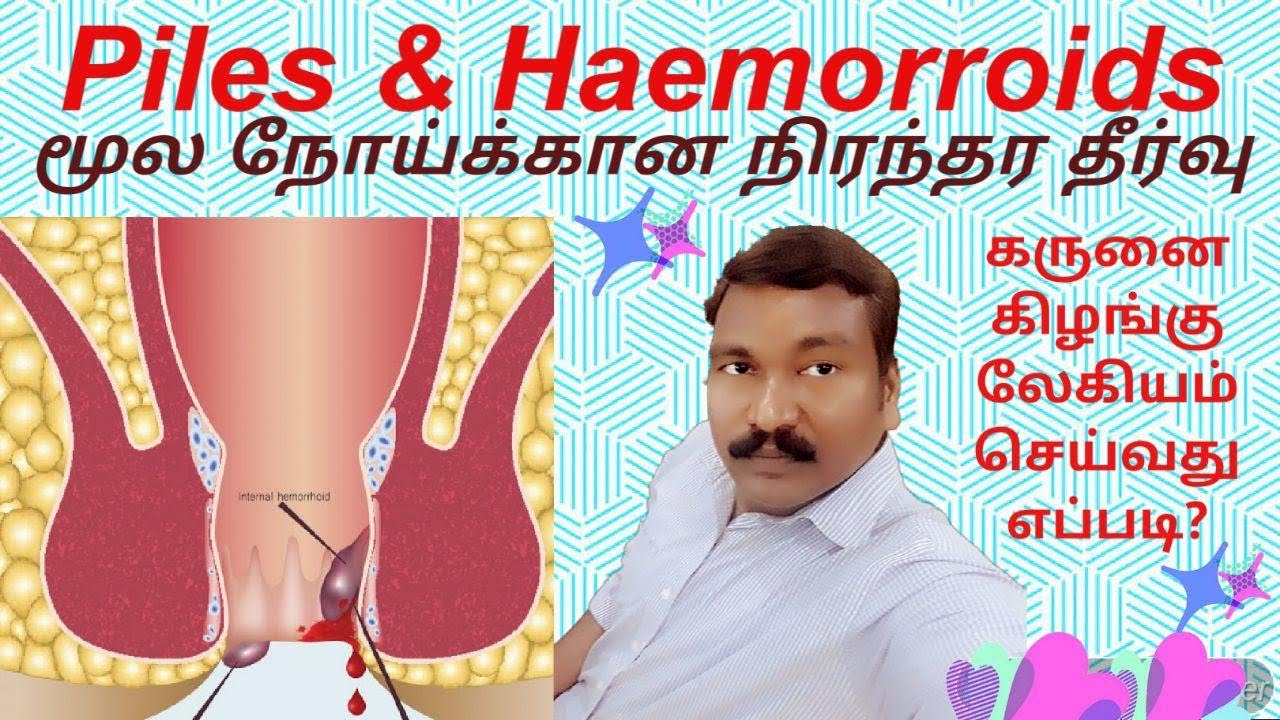 Piles | மூல நோய்க்கான நிரந்தர தீர்வு. - YouTube