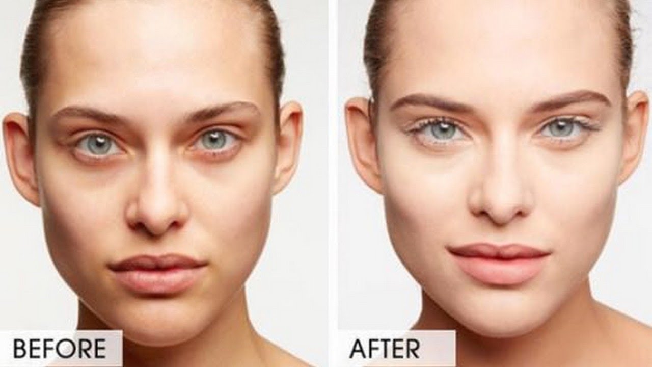 How to Get Rid of a Black Eye 6 Amazing Home Remedies That Really Works ...