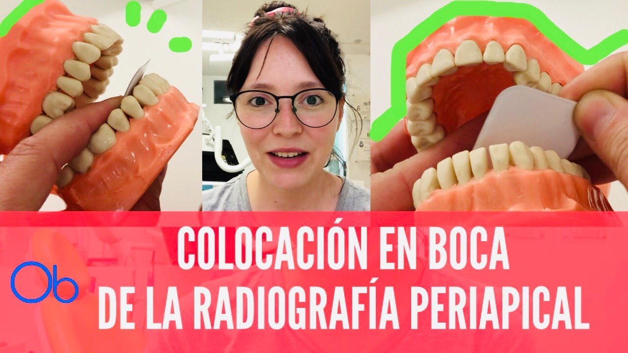 Cómo colocar las Radiografías Periapicales en boca 👄 - YouTube