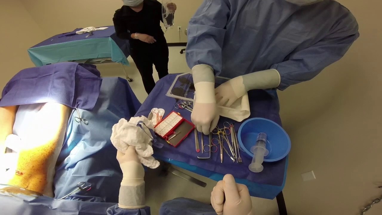 Calf Muscle Implant GoPro Surgery - YouTube