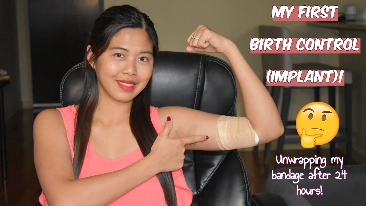MY FIRST TIME USING BIRTH CONTROL AND IT'S IMPLANT (NEXPLANON ...