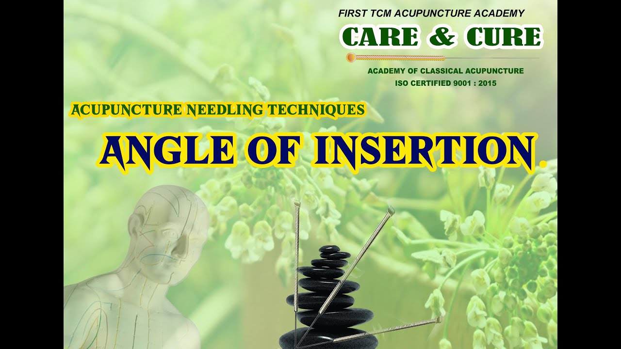 ACUPUNCTURE NEEDLING TECHNIQUE/ ANGLE OF INSERTION/ TCM ACUPUNCTURE IN ...