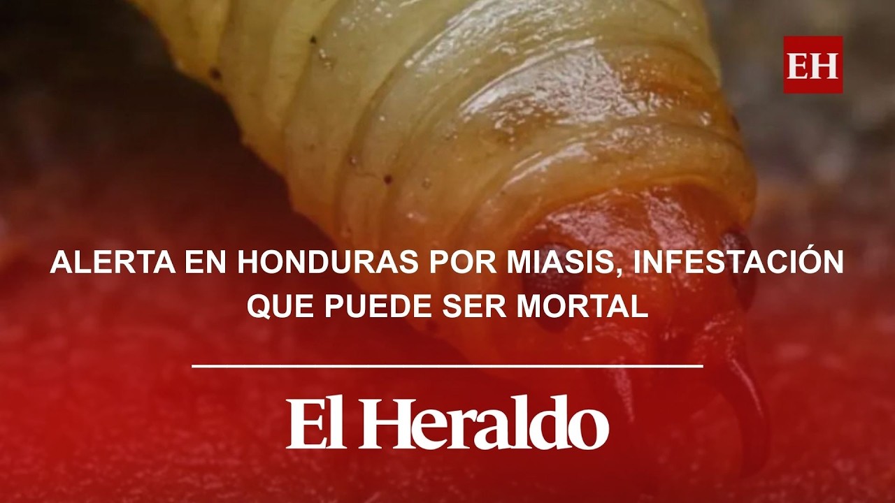 ¿Qué es la miasis, cómo se desarrolla y por qué puede ser mortal? - YouTube