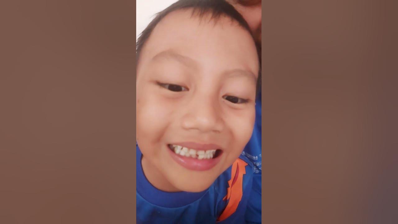 Ketika Gigi Dewasa Ryu Tumbuh Gigi Susu Ryu Mau Copot Youtube