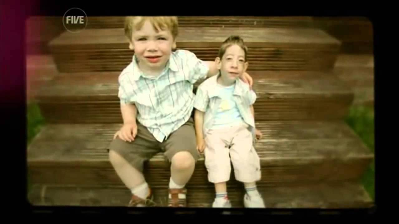 Growing Up Without A Face1 - YouTube