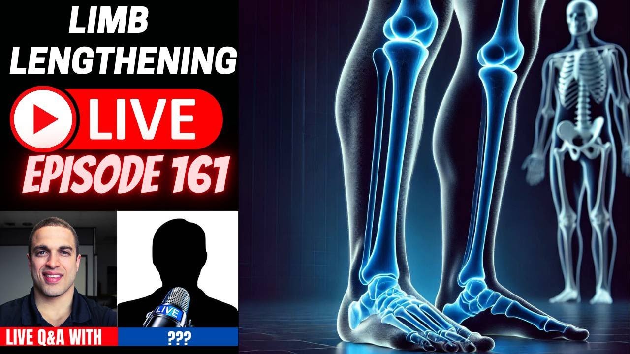 LL LIVE Ep. 161 - Interview with Cosmetic Limb Lengthening Patient who ...