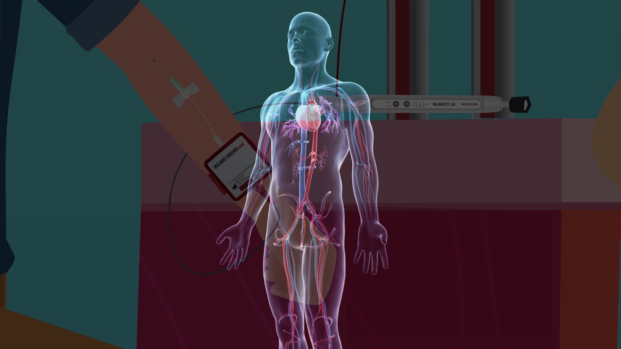 haemo-laser animation mit untertitel - YouTube