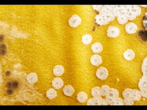 How To Remove Mildew From Vintage Wool Clothing