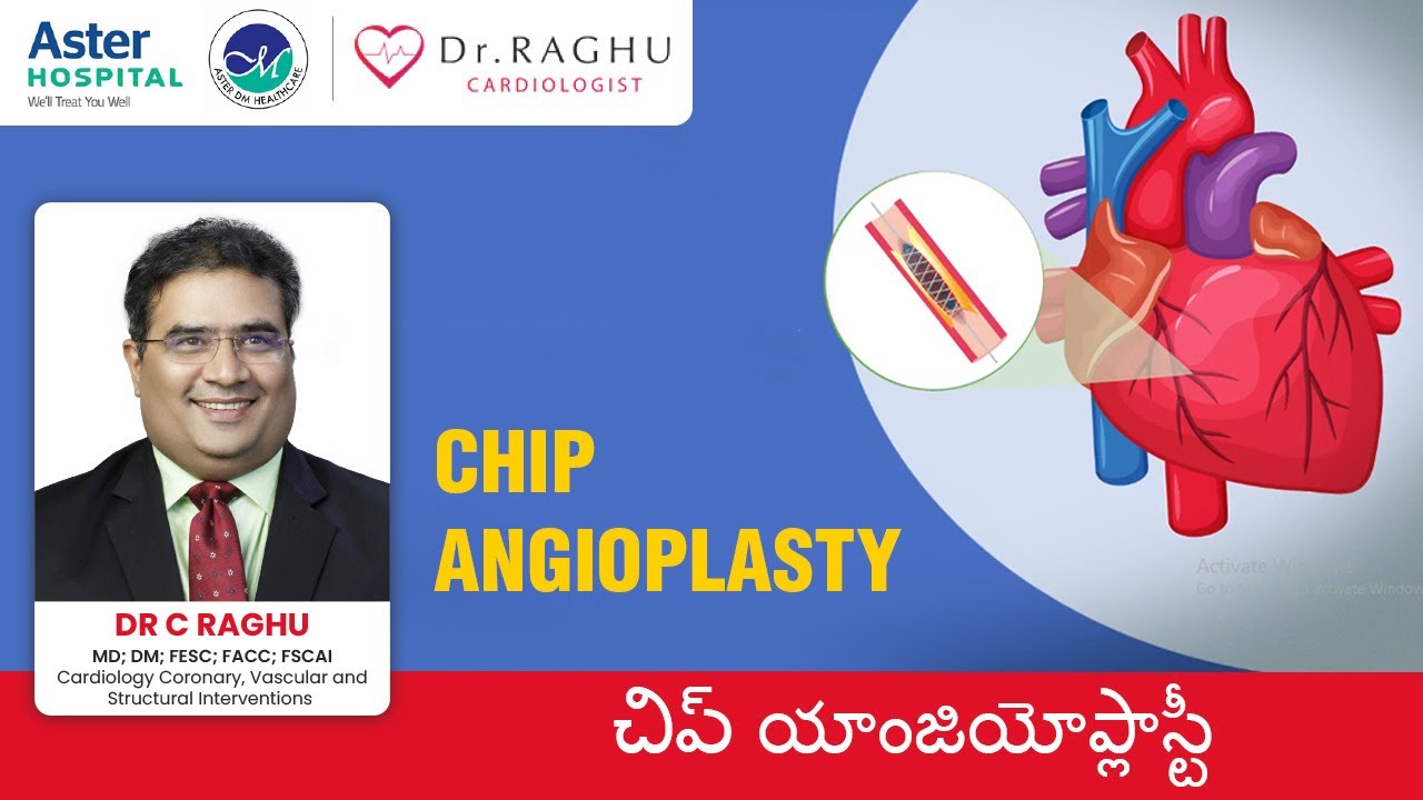 When to prefer CHIP treatment | How is CHIP Treatment beneficial| Dr C ...